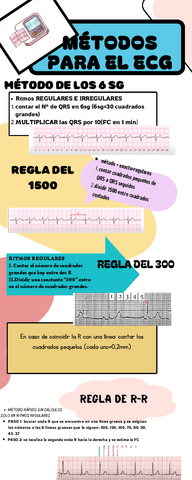 Infografia-metodos.reglas-ECG-1.pdf
