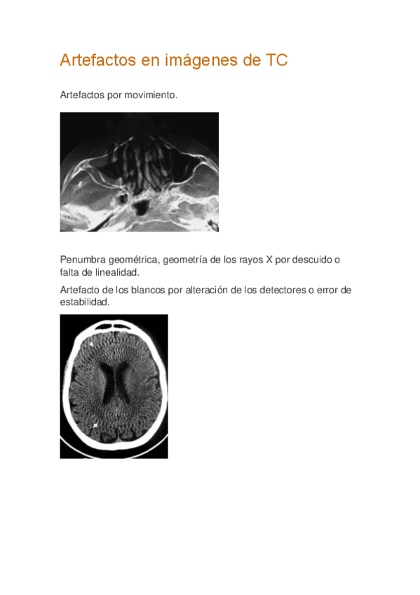 Artefactos-en-imagenes-de-TC.pdf