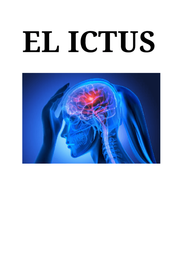 El-ictus.pdf