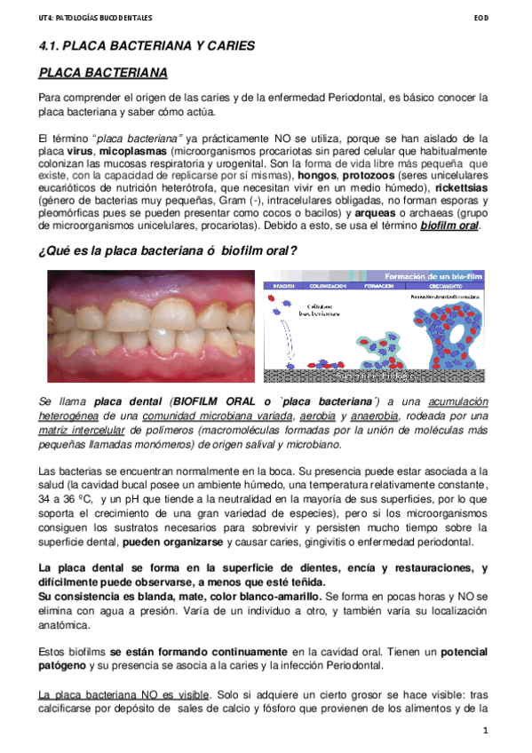 UT4..-PLACA-BACTERIANA-Y-CARIES-1.pdf