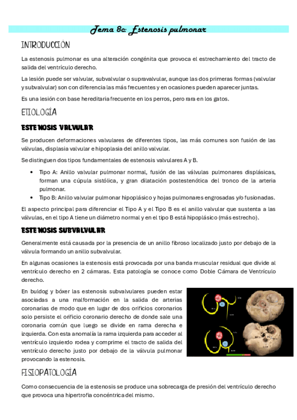 Tema-8c-estenosis-pulmonar.pdf