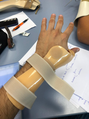 FERULA-RADIAL-TENDINITIS-QUERVAIN.jpg