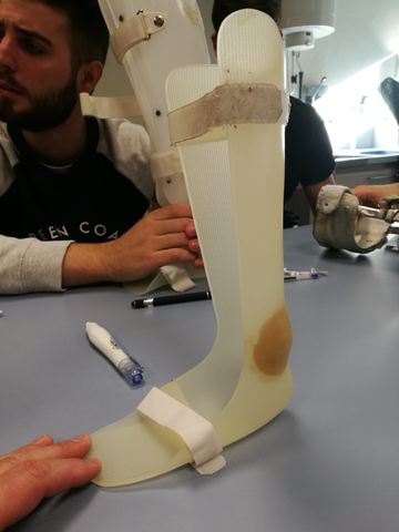 FERULA-POSTERIOR-PASIVA-ANTIEQUINO.jpg