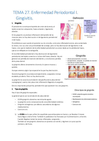 tema 27 enfermedad periodontal. gingivitis.pdf