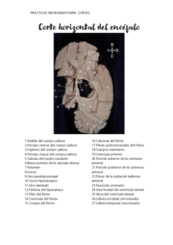 Corte-horizontal-del-encefalo.pdf