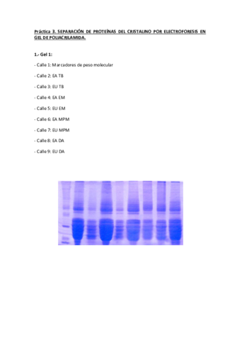 PRACTICA-ELECTROFORESIS.pdf