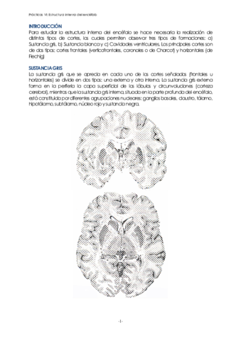 PRACTICA-6-2-MORFOLOGIA-INTERNA-DEL-SNC.pdf