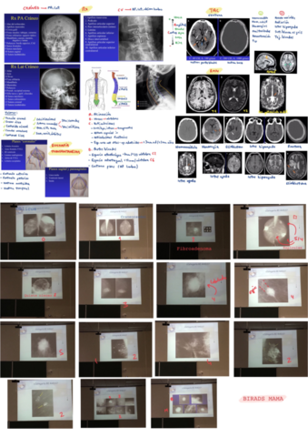 Esquema-SNC-y-mama.pdf