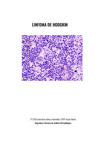 LINFOMA-DE-HODGKIN.pdf