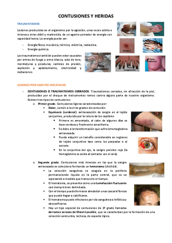 TEMA-4-CONTUSIONES-Y-HERIDAS.pdf