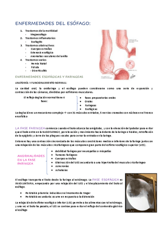 ENFERMEDADES-DEL-ESOFAGO.pdf