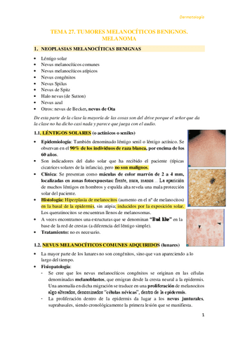 Tema-27-Tumores-cutaneos-melanociticos.-Melanoma.pdf