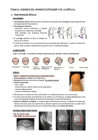 T9.-Lesiones-del-aparato-extensor-y-rotula.pdf