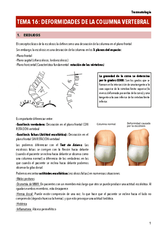 T16-DEFORMIDADES-DE-LA-COLUMNA-VERTEBRAL.pdf