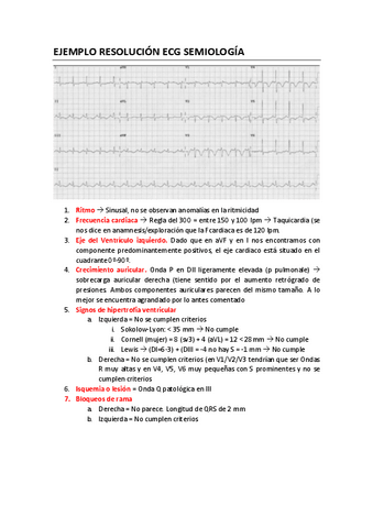 EJEMPLO ELECTRO ECG RESUELTO.pdf